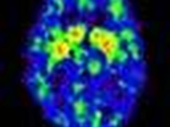 FRONTLINE | The Meth Epidemic | Season 2006 | Episode 6 | PBS