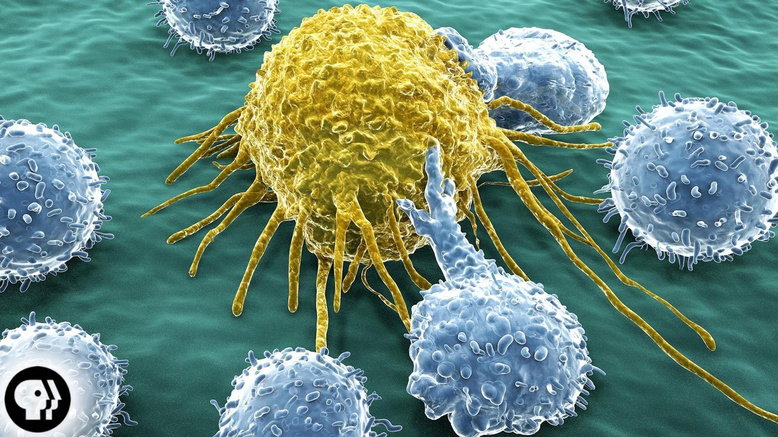 Why Do So Many People Get Cancer? | Braincraft | PBS LearningMedia