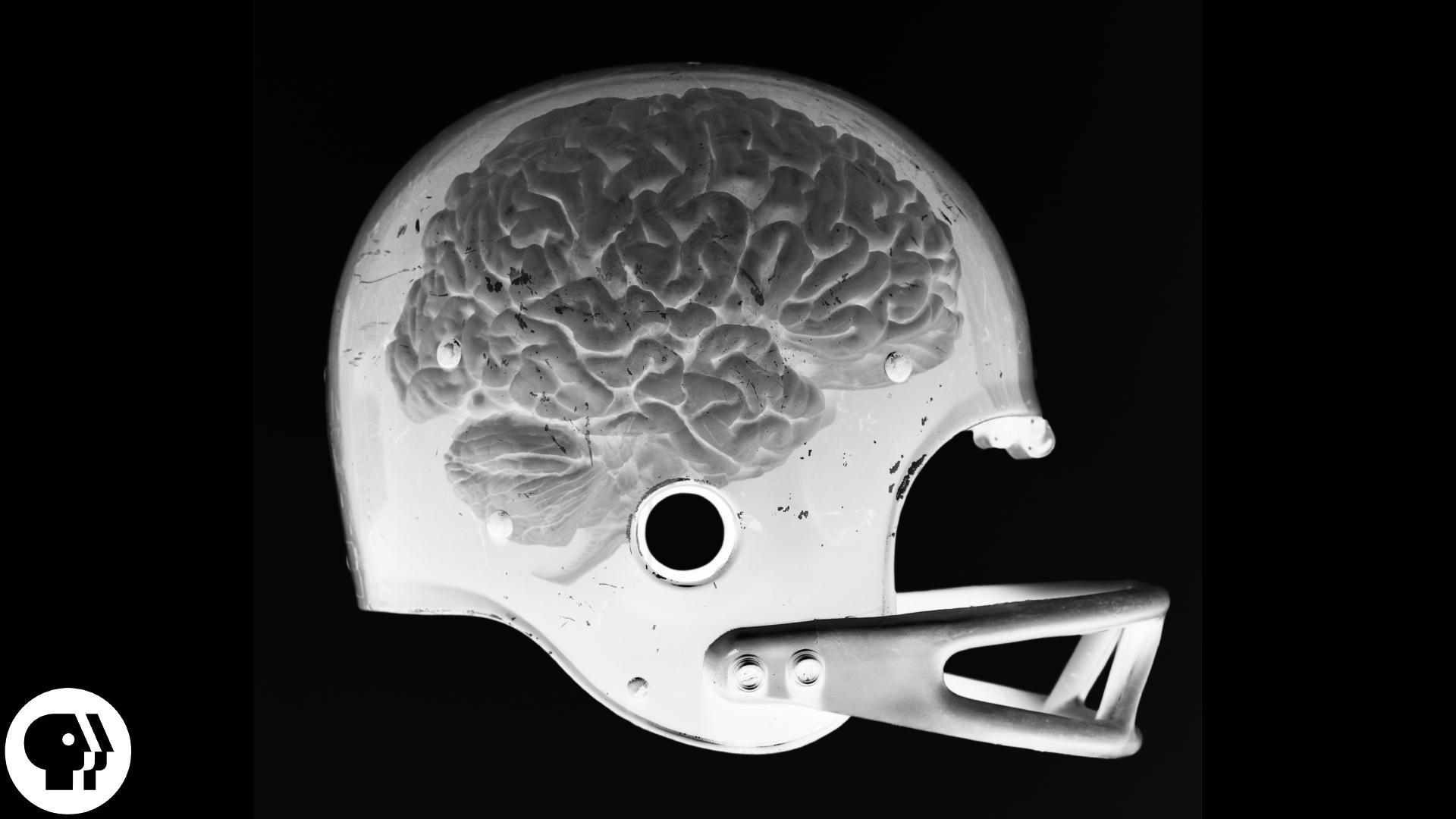Are Concussions Deadly? | Braincraft | PBS LearningMedia