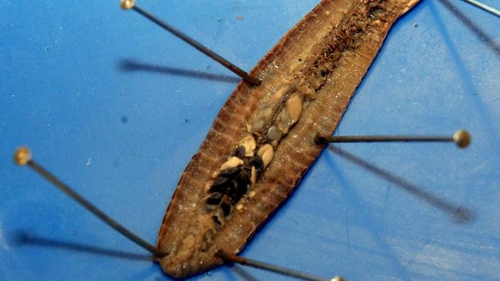 Virtual Worm Dissection Mrs Dildy