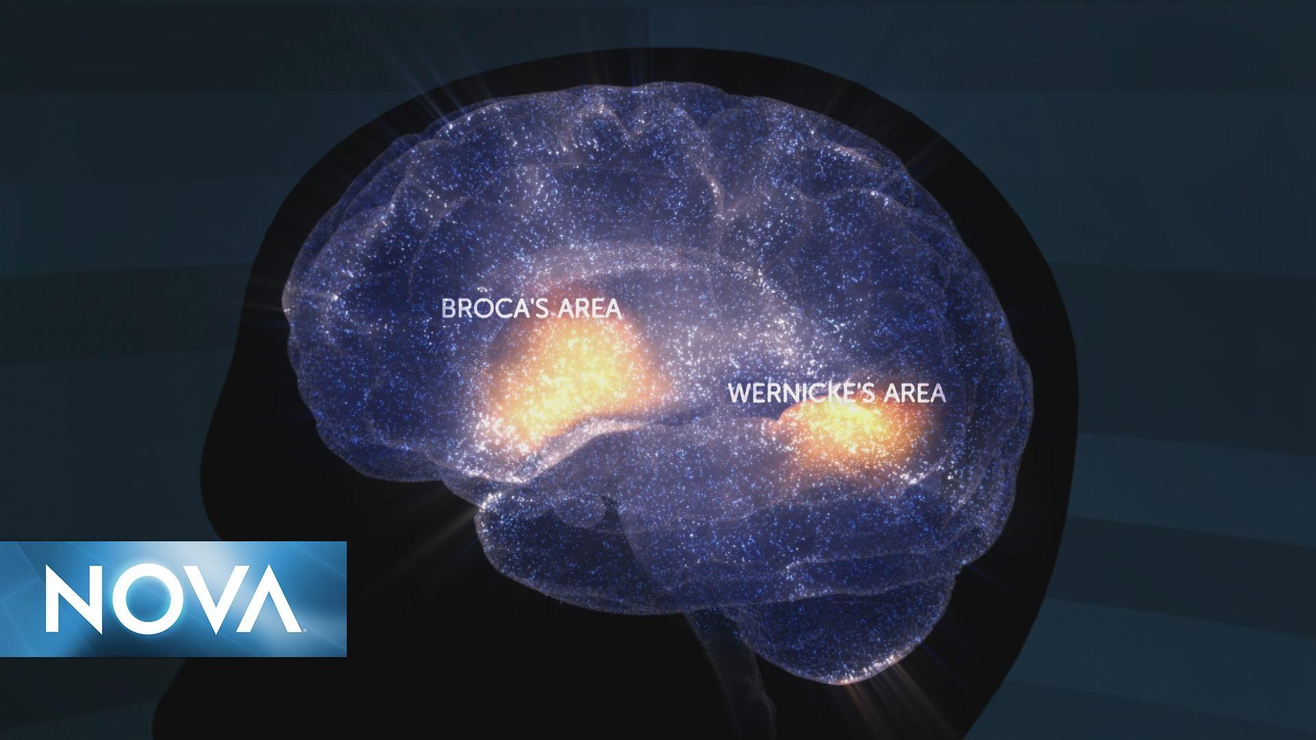 School of the Future | How Reading Interventions Impact the Brain ...