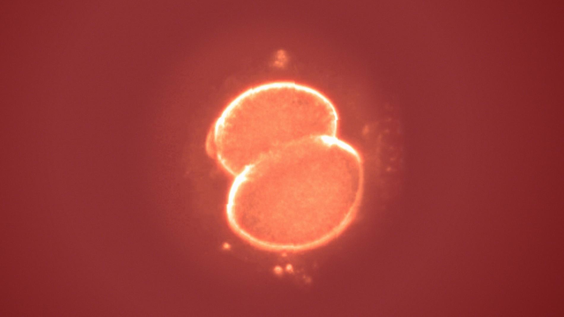 In the Race for Life, Which Human Embryos Make It? | Deep Look | PBS ...