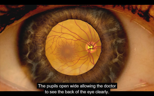 Dilated Eye Exam Animation | Science, Health and Physical Education ...