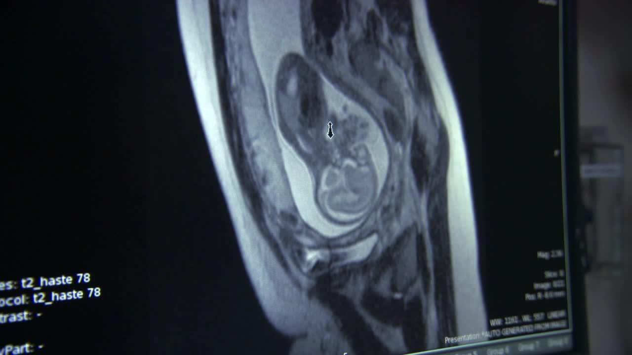 Planning an EXIT Procedure | Twice Born | PBS LearningMedia