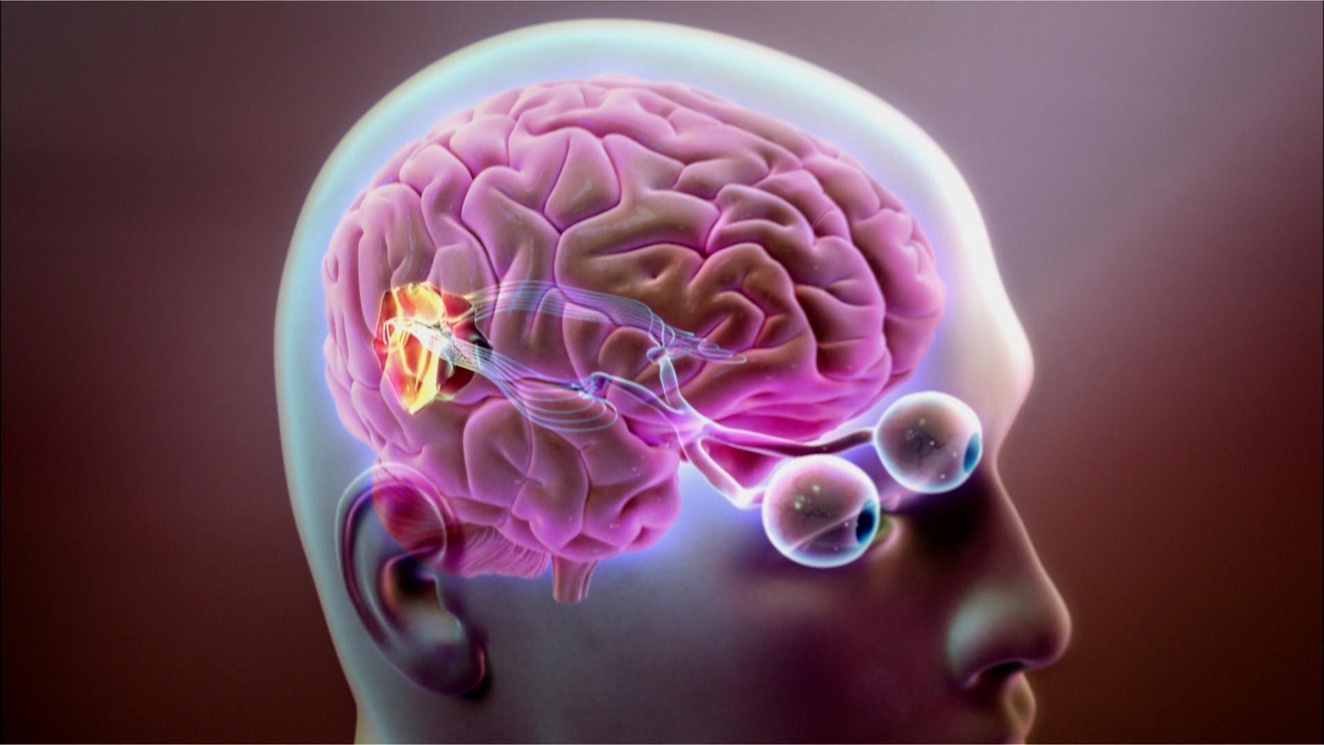 Magic And The Brain PBS LearningMedia