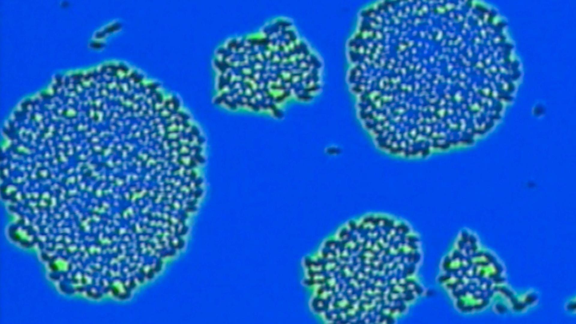 Why Does Evolution Matter Now? | PBS LearningMedia