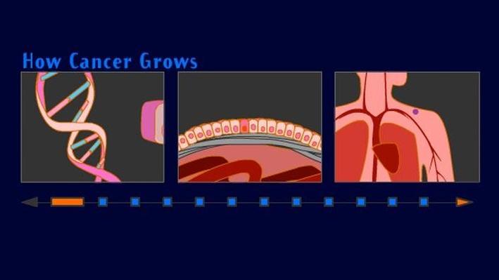 How Cancer Grows | Science | Interactive | PBS LearningMedia