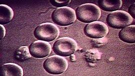 A Mutation Story | PBS LearningMedia