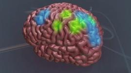 The Human Spark | The Brain in Action | PBS LearningMedia