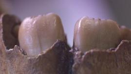 The Human Spark | What Teeth Can Tell | PBS LearningMedia