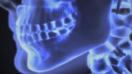 NASA | Electromagnetic Spectrum: X-rays | PBS LearningMedia