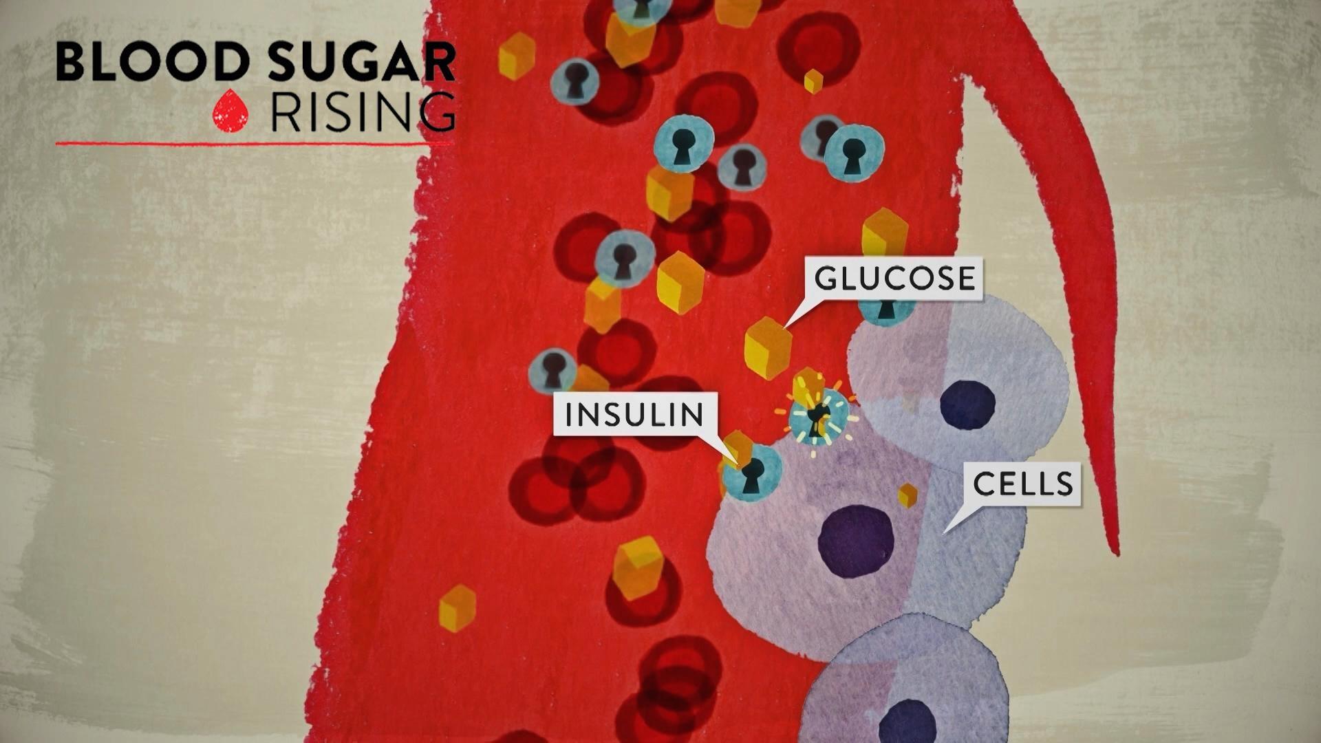 Investigating the Growing Health Crisis of Diabetes Lesson Plan | Blood ...