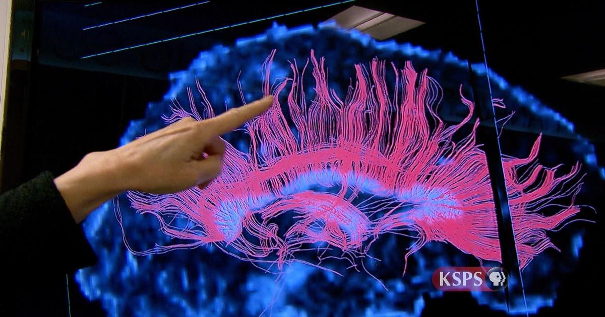 KSPS Documentaries | Inside Babies’ Brains | PBS KSPS Documentaries | Inside Babies’ Brains | PBS