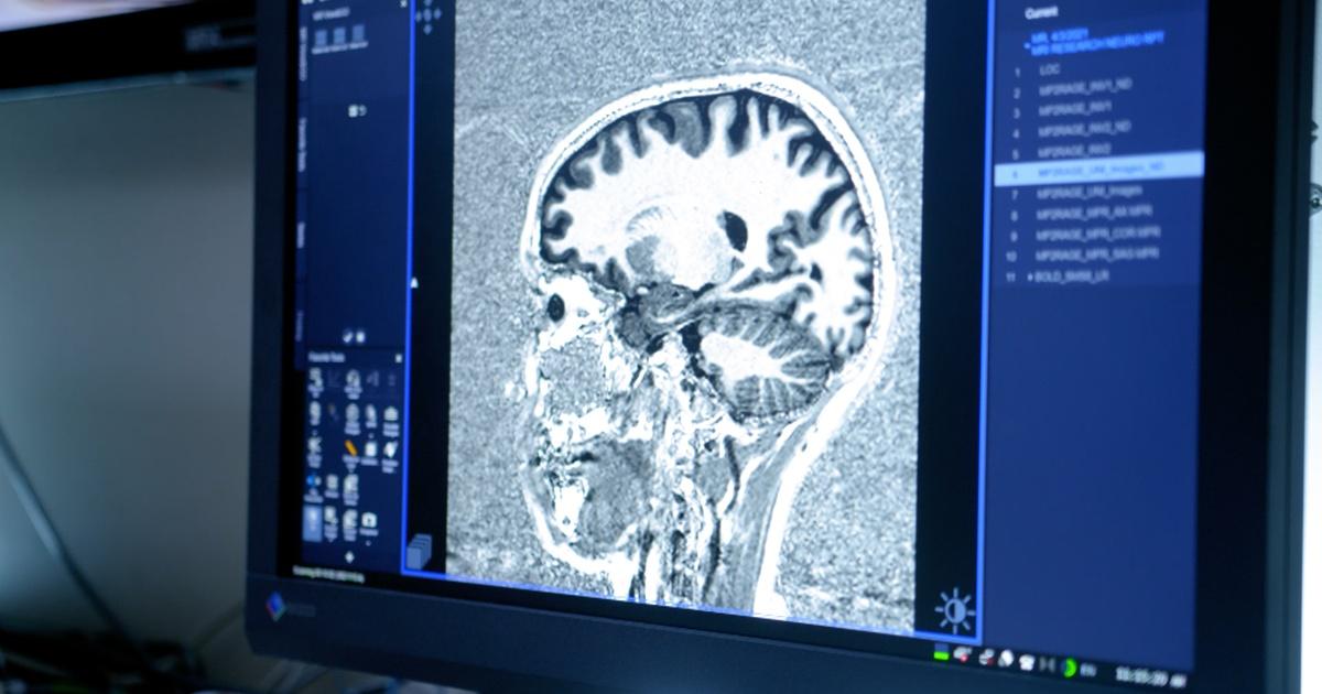 NOVA | How Does a Brain on THC Compare to a Brain on CBD? | Season 48 | PBS