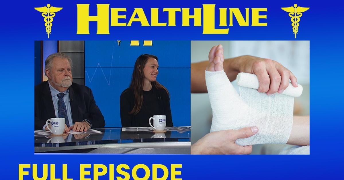 HealthLine | Wound Care | Season 2025 | Episode 3902 | PBS
