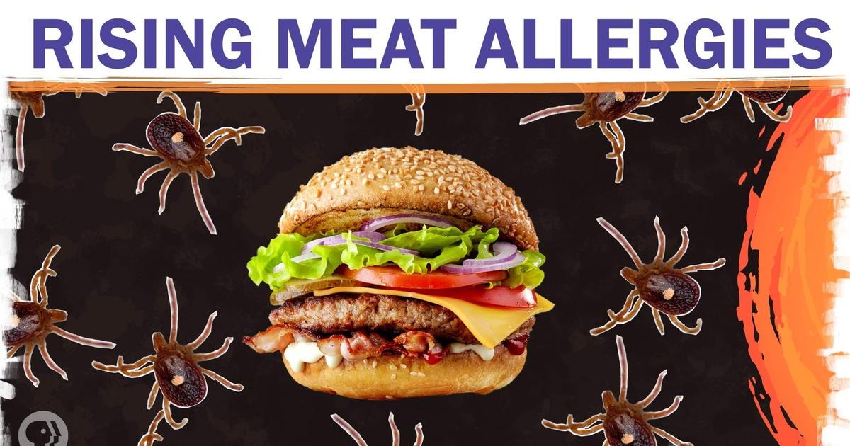 Hot Mess | Could climate change make you allergic to meat? | PBS