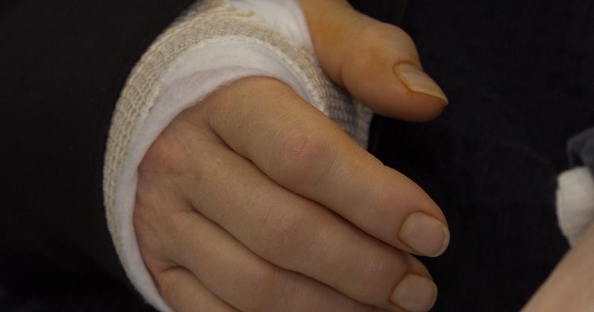 PBS39 News Reports | FREE HAND SURGERY | Season 2020 | PBS