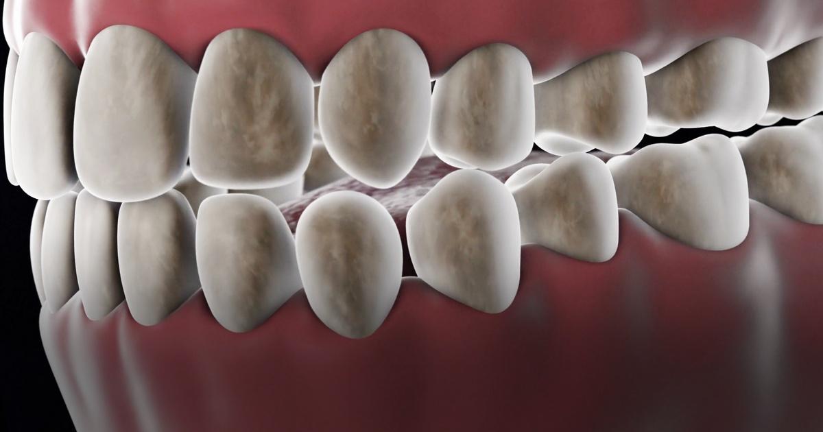 Eons | The 40 Million-Year-Old Ecosystem In Your Mouth | Season 4 ...