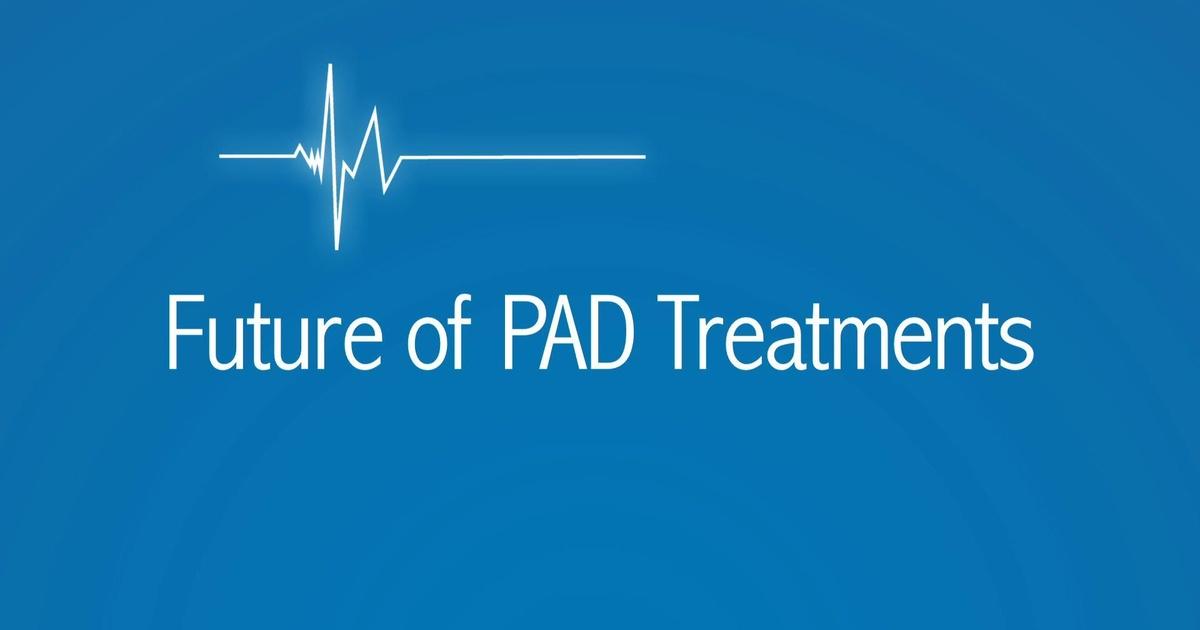 The Latest Procedure | Future of PAD Treatment | PBS