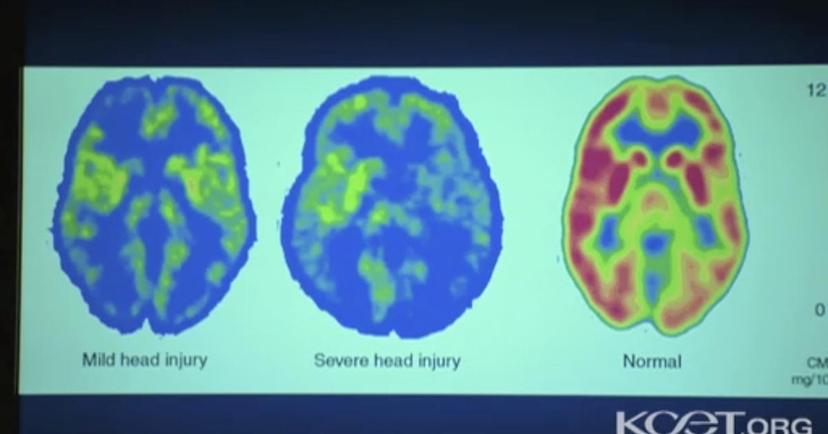 SoCal Connected | Knocking Heads | PBS