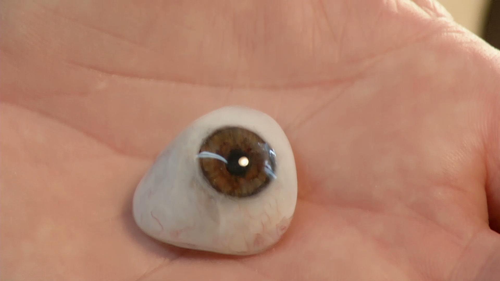 Strikingly real prosthetic eyes | SciTech Now | WLIW