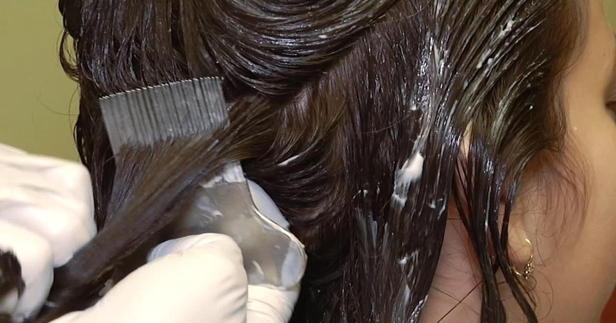 Njtv News Know How To Prevent And Treat Head Lice Pbs 8048