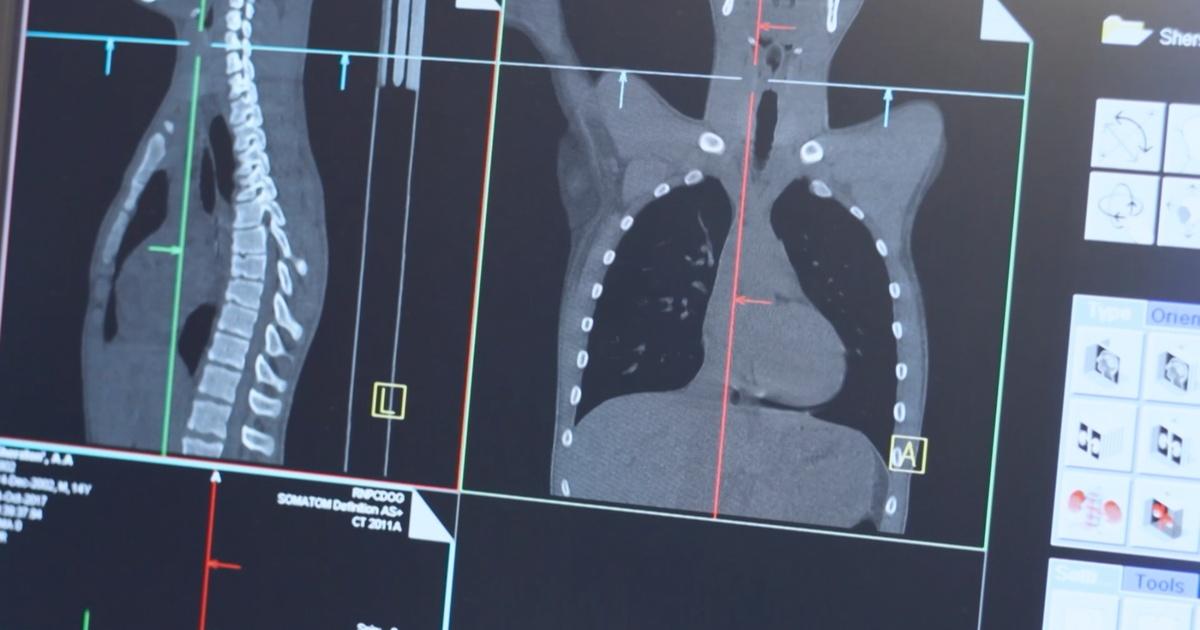 PBS Reno STEM Works | Reno Orthopedic Center | ROC | Season 2021 | PBS