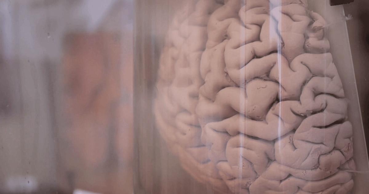 SCI NC | Why Is a Mini-Brain Helpful? | PBS