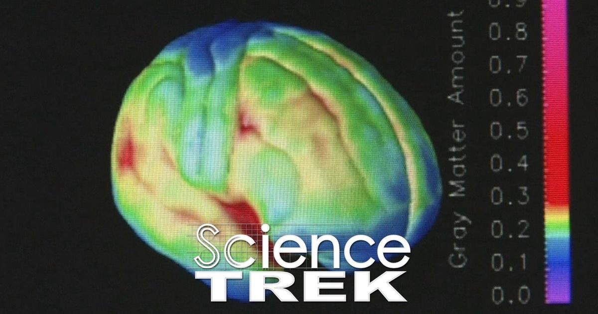 Science Trek | The Brain: Mental Health | PBS