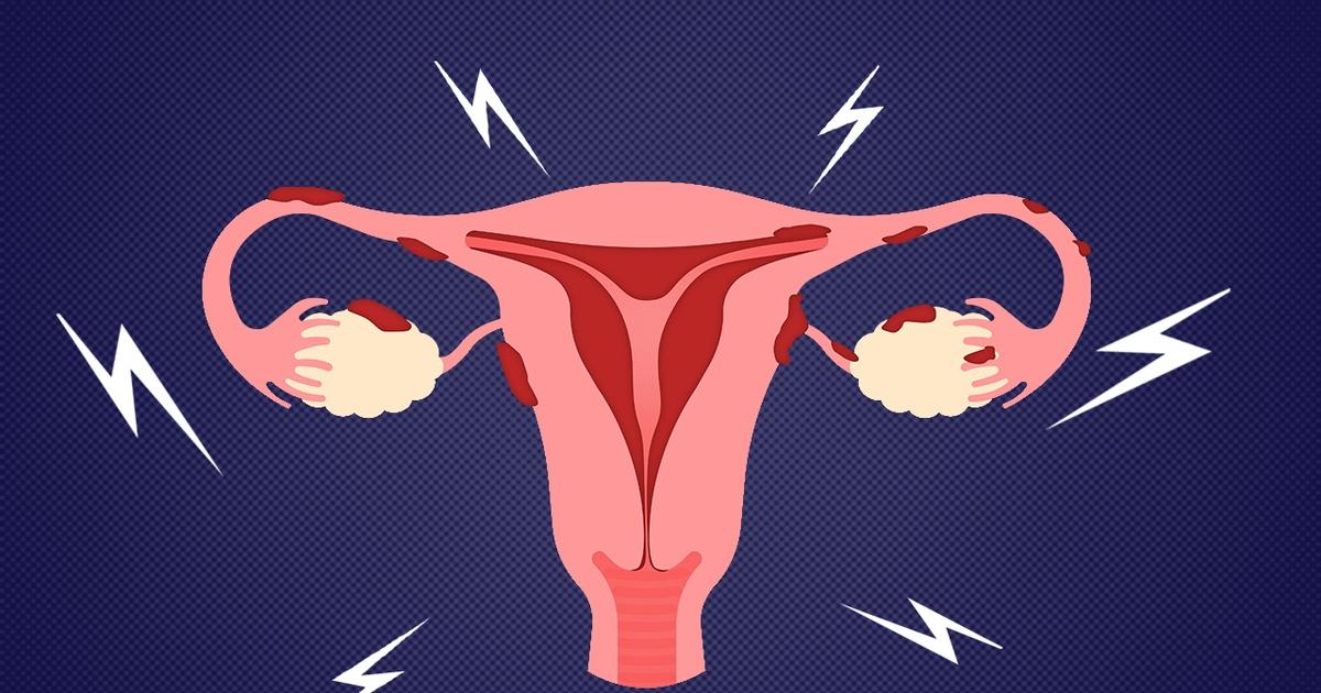 Vitals | Why Endometriosis Patients Keep Getting Gaslit | Season 1 ...