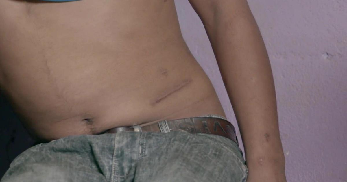 Pbs News Hour Trafficking Victims Forced To Sell Organs Share Stories