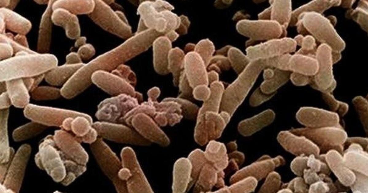 PBS News Hour | A New Genetic Map That Could Make Your Skin Crawl ...