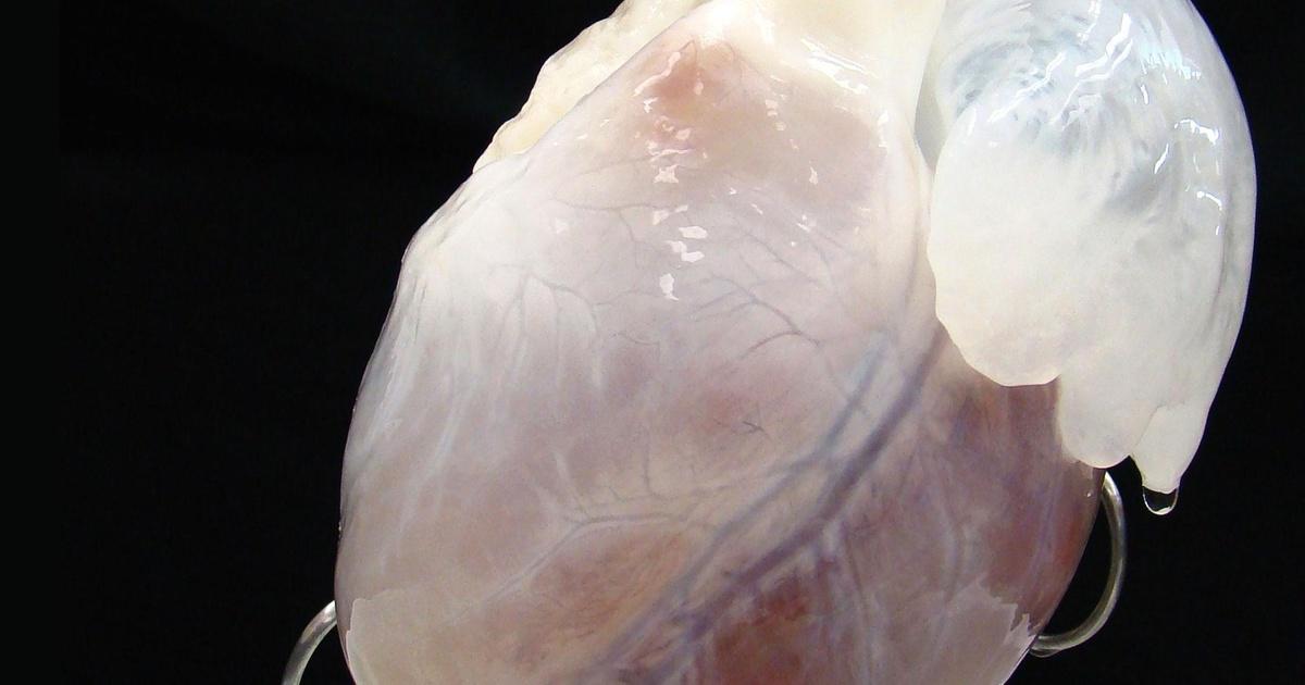 NOVA scienceNOW | Can We Live Forever? Preview | Season 5 | Episode 2 | PBS