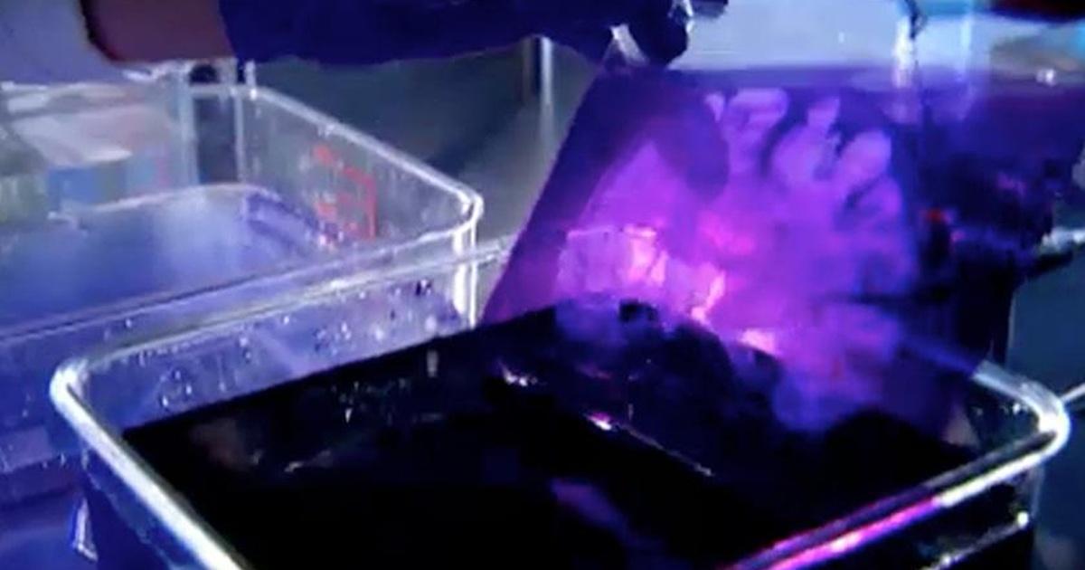 NOVA scienceNOW | Viewing H.M.'s Brain | Season 6 | PBS