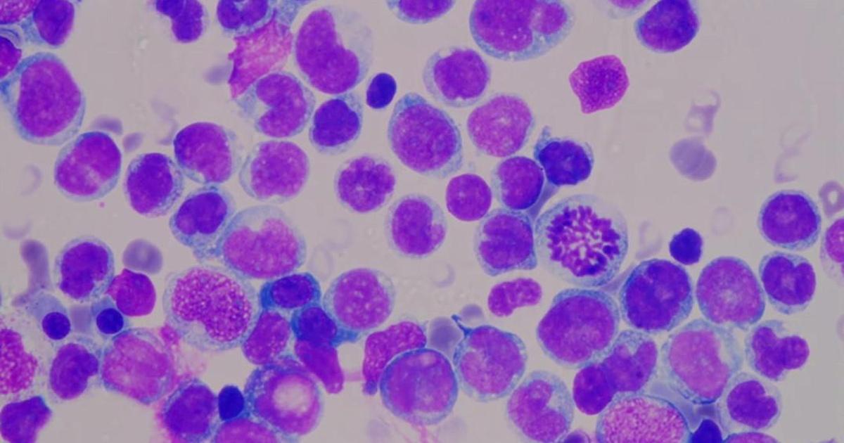 Cancer: The Emperor of All Maladies | Intro | PBS