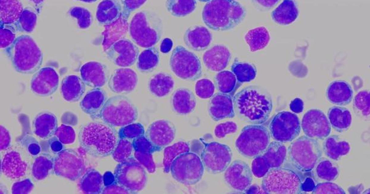 Cancer: The Emperor of All Maladies | What is Cancer? | PBS