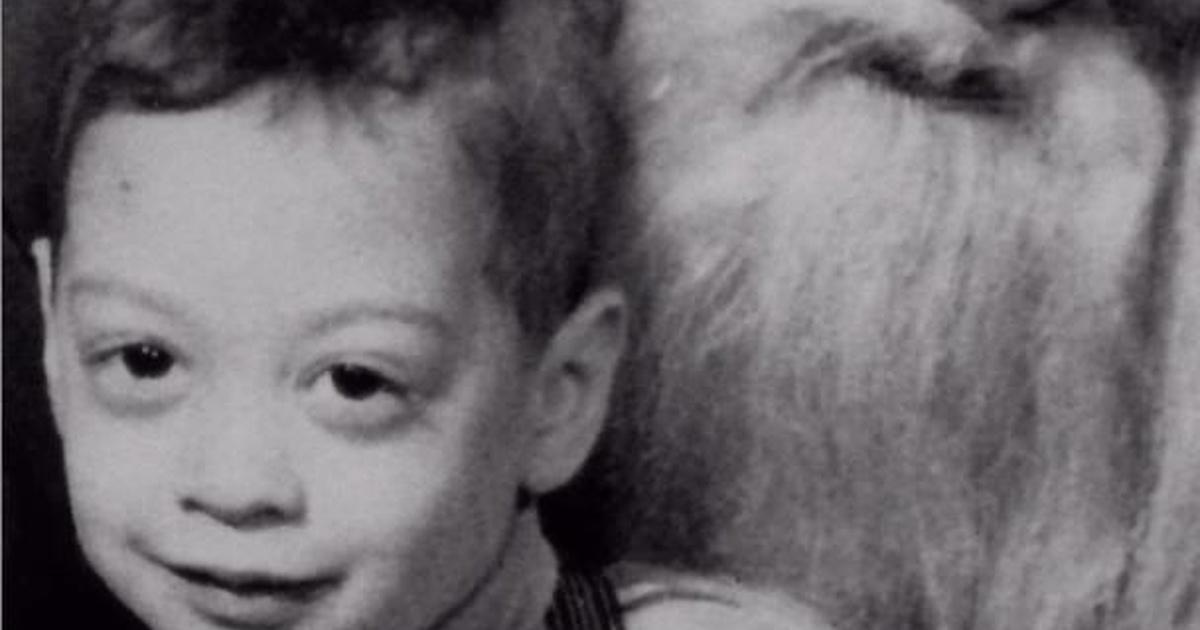 Cancer: The Emperor of All Maladies | Robert Sandler | PBS